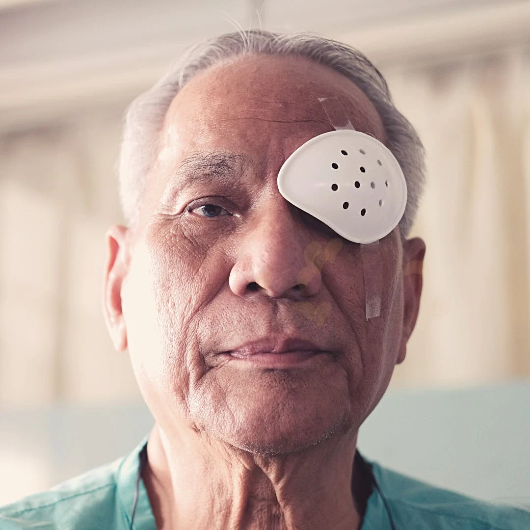 Sleeping Position After Cataract Surgery EyeFACTS